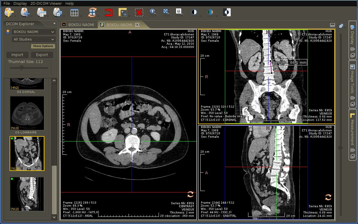 Os 25 principais visualizadores gratuitos do Dicom para médicos ...